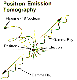Physiology physics woven fine: PET Scan: Particle Physics And ...