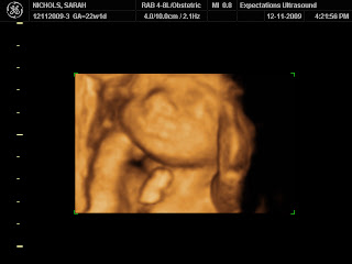 The Nichols Family: 3d/4d Ultrasound 22 Weeks!
