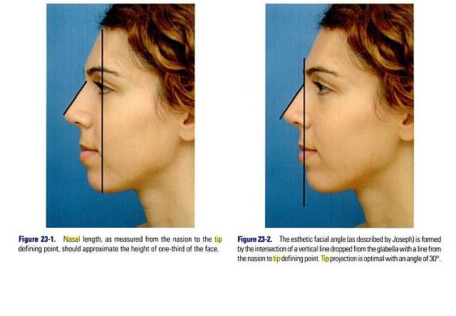 Nose Revision Surgery and Surgeons: The Nose Tip: Dimensional Analysis 101