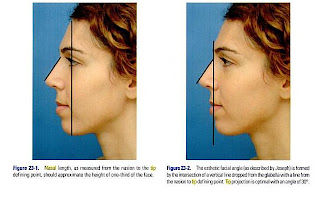 Nose Revision Surgery and Surgeons: The Nose Tip: Dimensional Analysis 101