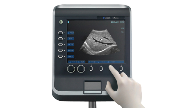 SonoSite S-Series portable ultrasound tools ~ Japan Blog
