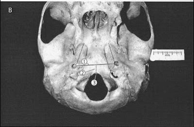Chimpanzee Information: Picture, Chimpanzee Skull