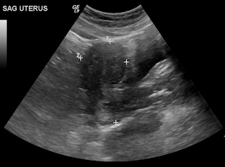 Montgomery College - Diagnostic Medical Sonography: Wk 11 Blog 2 Case ...