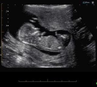 EL EMBARAZO MES A MES: El tercer mes de embarazo