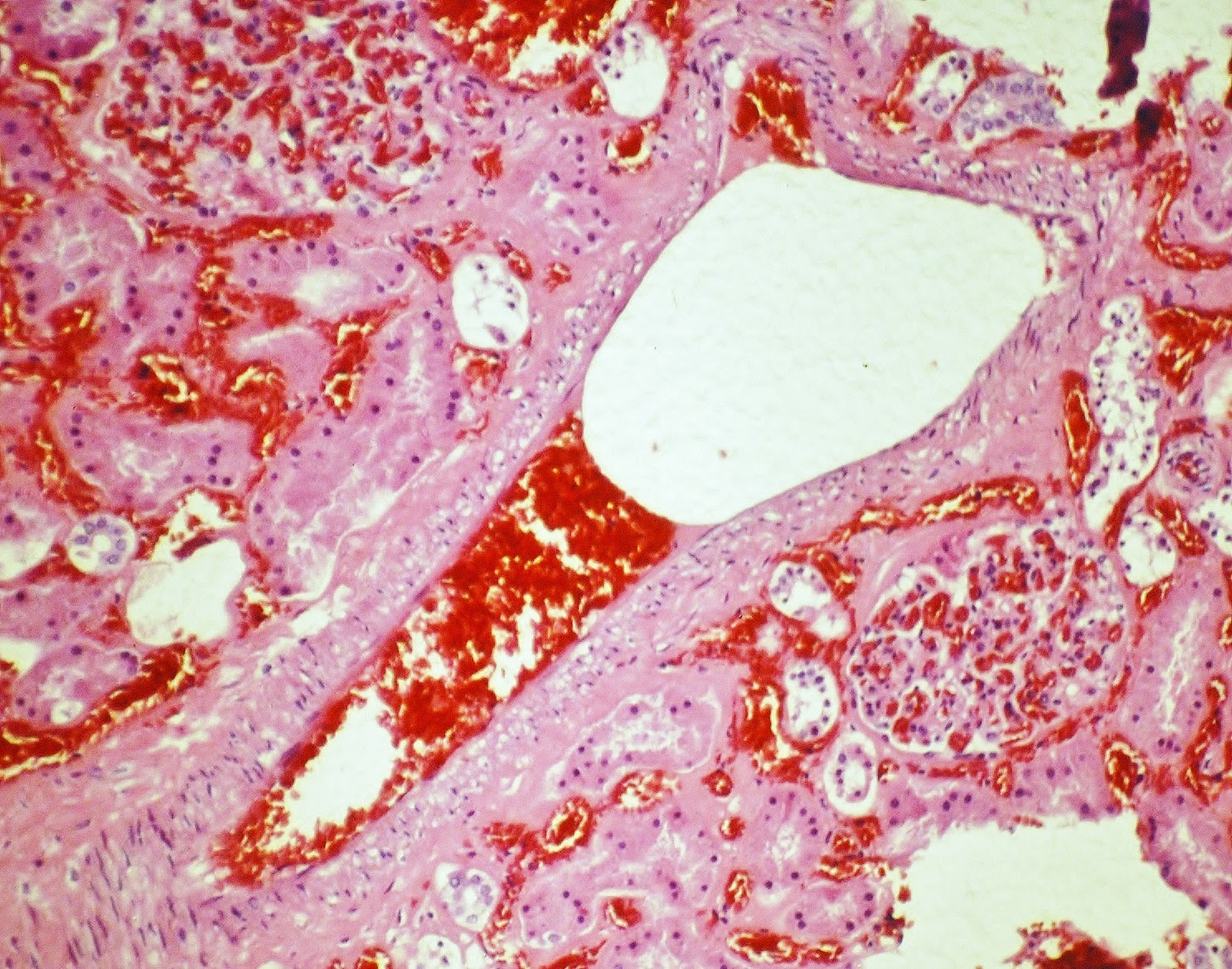 ForensicPathologyForum (HISTOPATOLOGÍA FORENSE PRÁCTICA): 3.-AIR ...