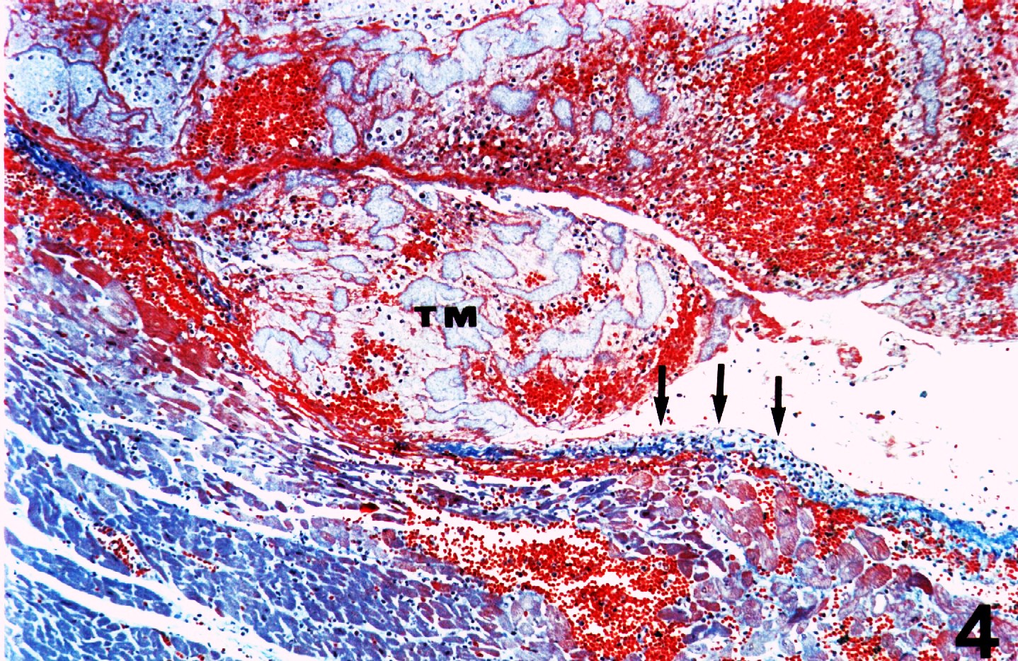 HISTOPATOLOGIA FORENSE PRACTICA (FORENSIC PATHOLOGY FORUM): 03/05/09