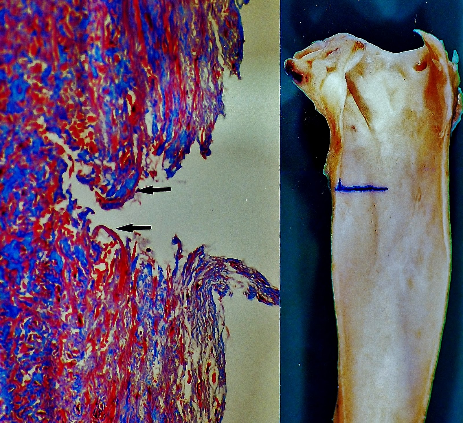 HISTOPATOLOGIA FORENSE PRACTICA (FORENSIC PATHOLOGY FORUM): 6.-SIGNS IN ...