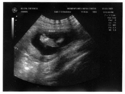 The Logue Family Grows: Second Ultrasound