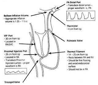 Anaesthesiology at Narayana Hrudayalaya