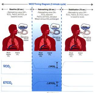 Anaesthesiology at Narayana Hrudayalaya