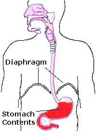 Remedies For Vomiting ~ Remedies For Health Problems