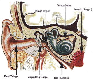 Alfiza: Bahaya Korek Telinga