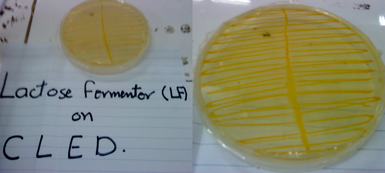 c.E.r.i.T.e.T.e.N.t.A.n.G.k.i.T.e.: Culture Media...