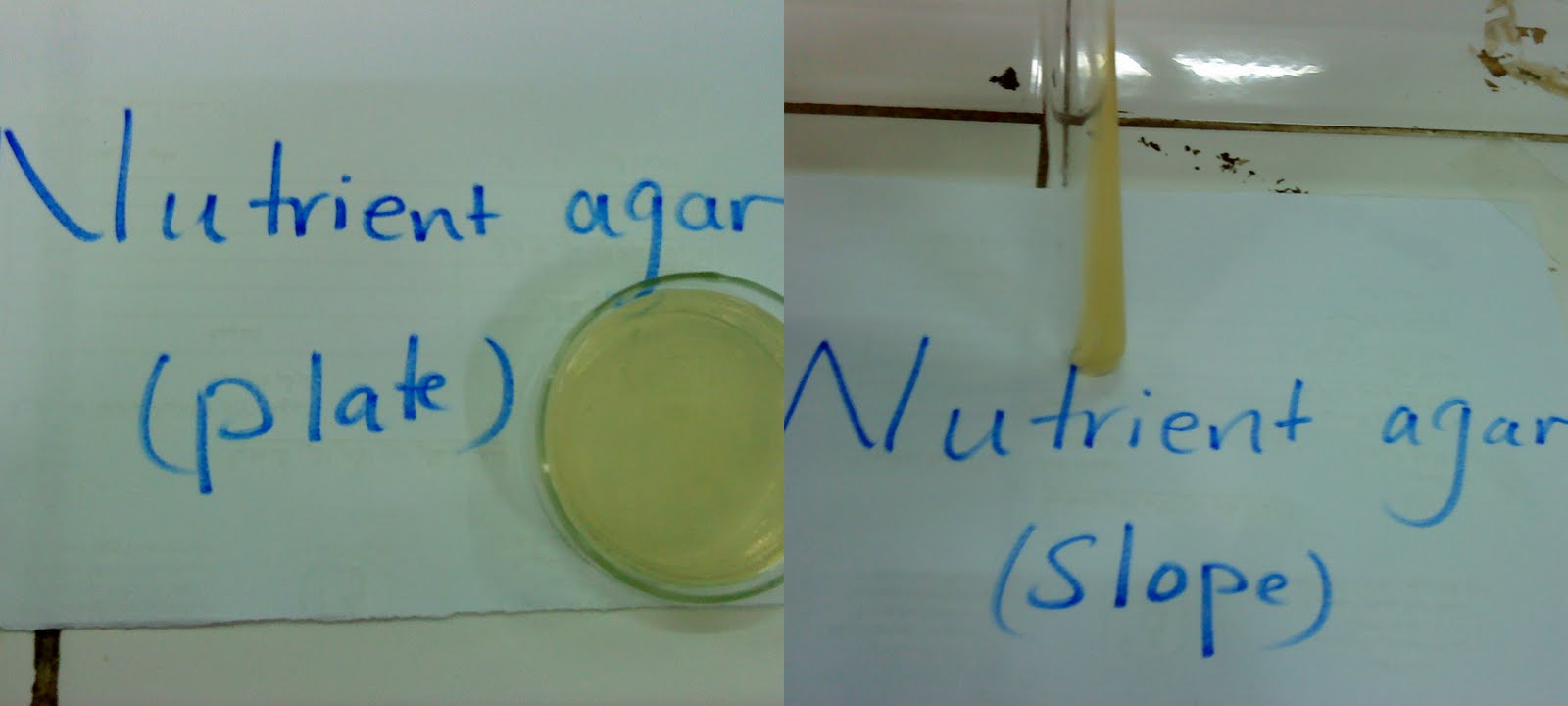 c.E.r.i.T.e.T.e.N.t.A.n.G.k.i.T.e.: Culture Media...