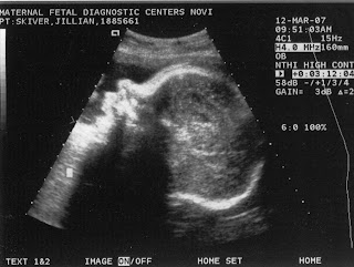 bloggers ate my babies: 36 week ultrasound