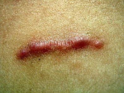 A Cicatriz [1948] - battlethepiratebay