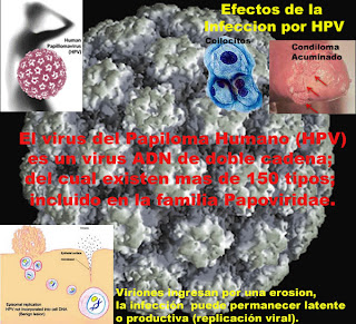 "Cáncer Cérvico Uterino y VPH": VIRUS PAPILOMA HUMANO HPV