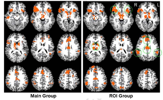 Neurology Center: How To Fool A Lie Detector Brain Scan