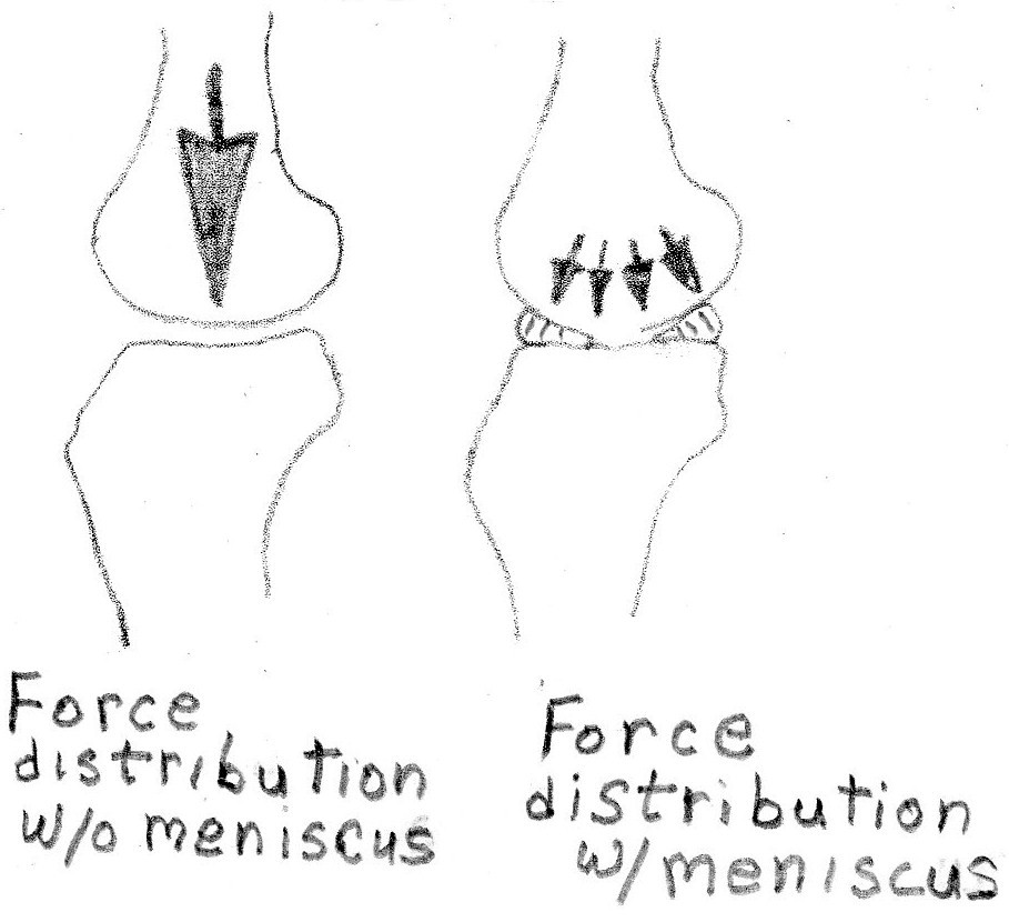 The Injured Athlete: ACL and MCL injuries: prevention through insight