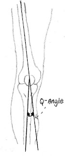 The Injured Athlete: ACL and MCL injuries: prevention through insight