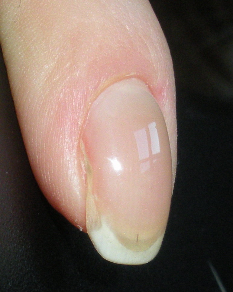 loodie loodie loodie: Nail Fix - Shellac prep and application