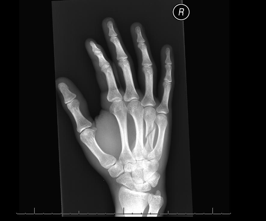 ROB RUIJGH: Valpartij tijdens training