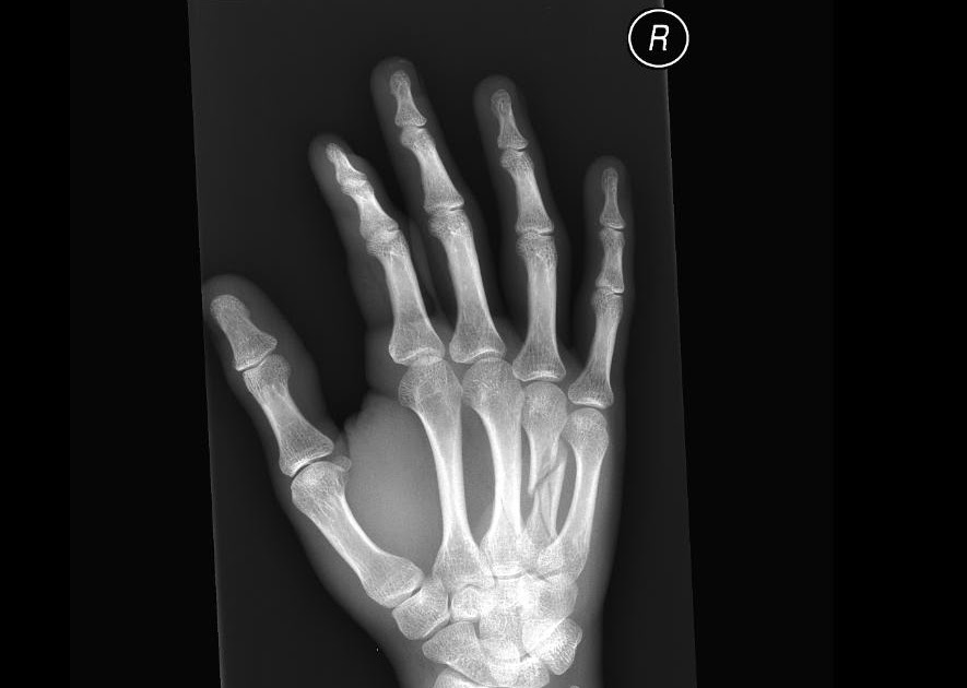 wat is dat??: röntgenstraling