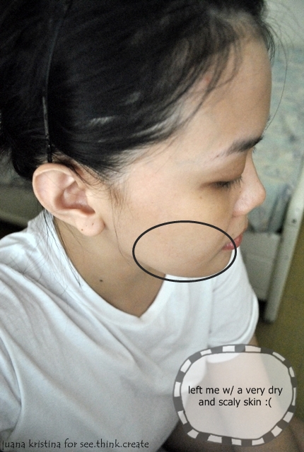 see.think.create: It's not Sunburn, It's Windburn!