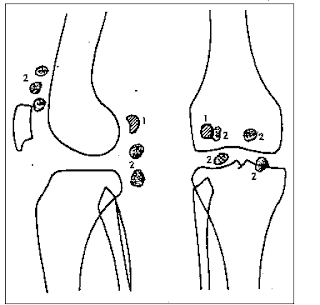 **KINESIOLOGIA**: _____RODILLA_____
