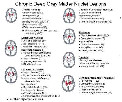 Neurohead: Bilateral grey matter lesions