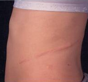 (PDF) Abdominal Examination - QMplus - DOKUMEN.TIPS