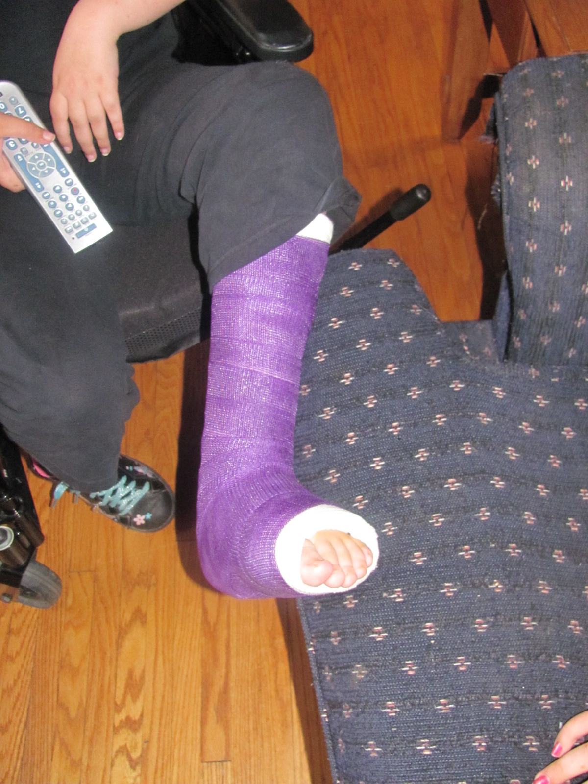 Kate's Blog: A Trip to the Fracture clinic and a new Purple Cast
