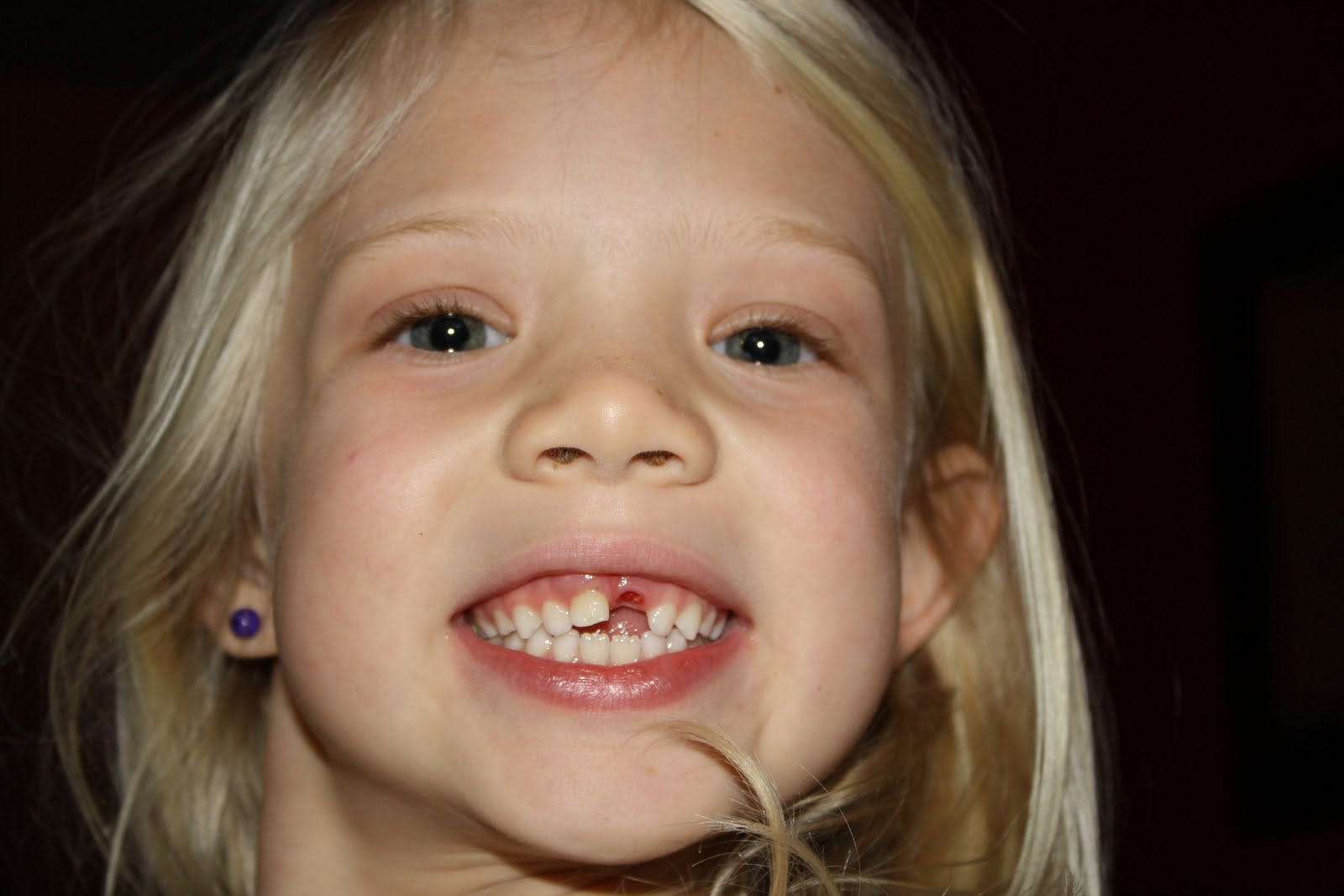 JONES FAMILY ADVENTURES: Another Lost Tooth