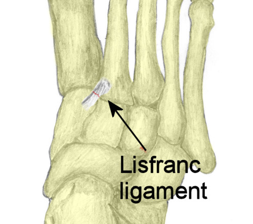 The Complacency Chronicles: COLUMN: Lisfranc