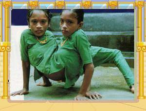 @ Conjoined Twins Human without the Leg ~ Amazing Kartika