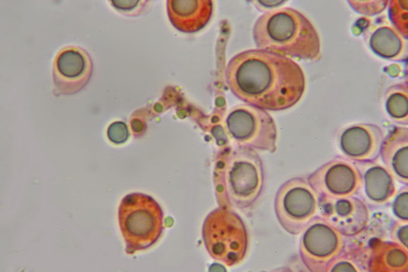 El mundo microscópico de los hongos: Basidiomicetos