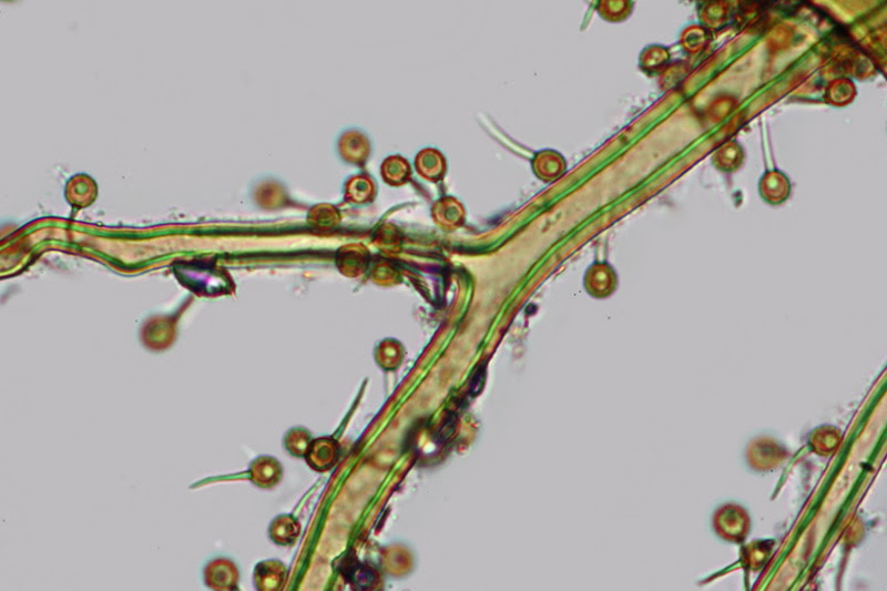 El mundo microscópico de los hongos: Gasteromicetos